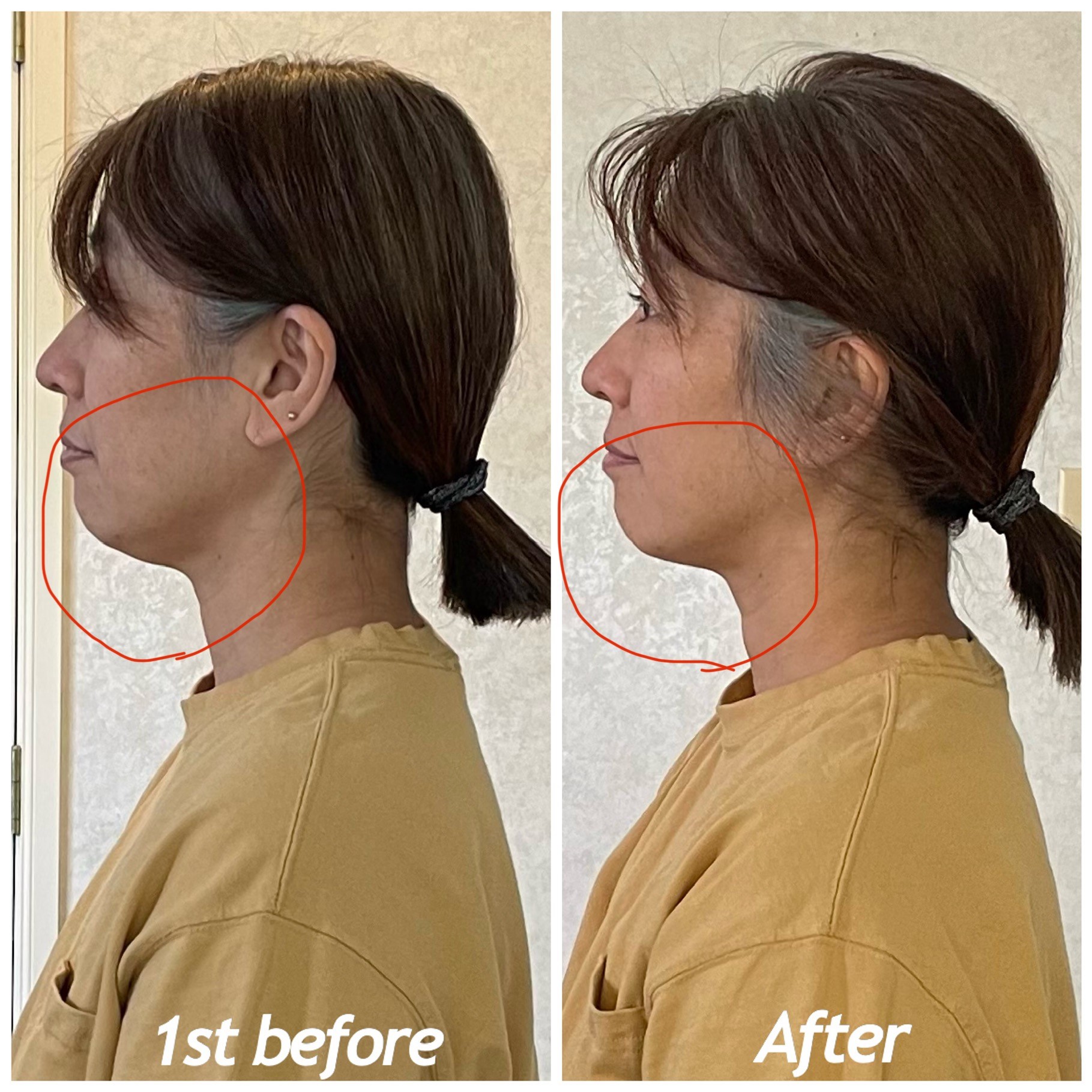 Sagging face disappear｜Kesae Total Balance | Japanese Cranial Beauty ...